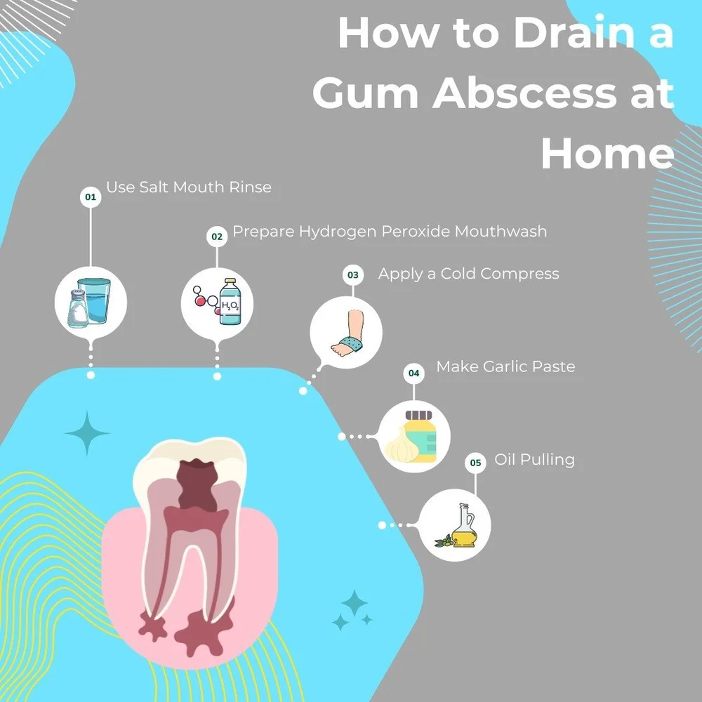 Gum Abscess Treatment: 9 Effective Methods To Try At Home — KWC Dental