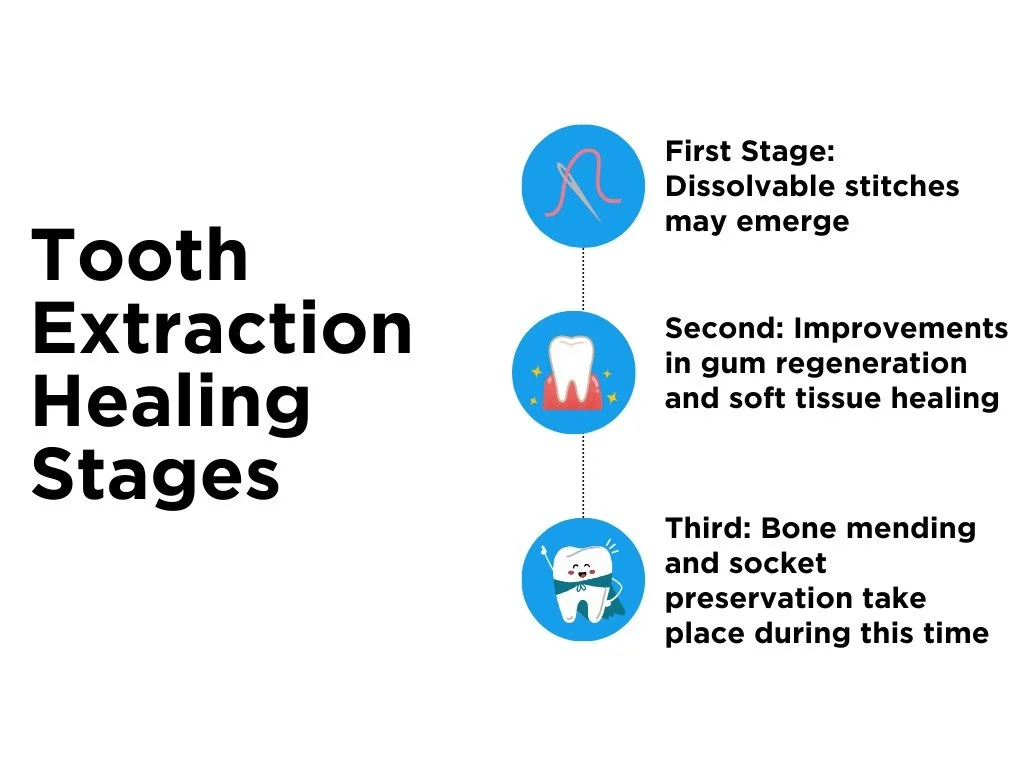 A Brief Guide on Tooth Extraction Healing Stages — KWC Dental