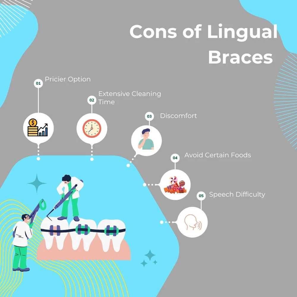 Lingual Braces: Functionality, Pros & Cons, And Cost — KWC Dental