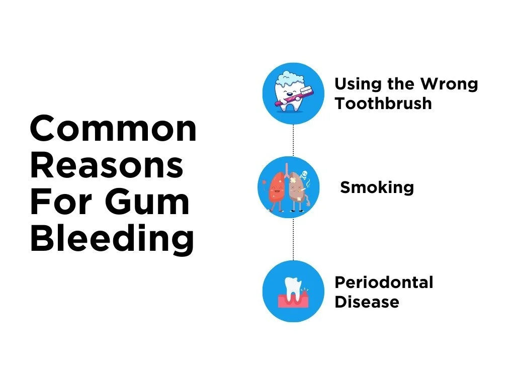 11 Best Ways to Stop Gum Bleeding Quickly at Home — KWC Dental