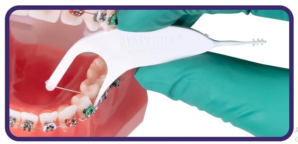 Top 8 Dental Floss for Braces - KWC Dental