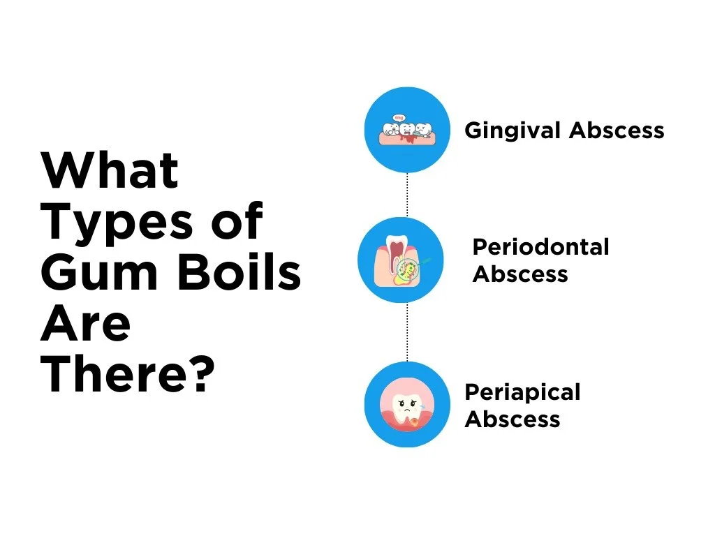 Gum Boil: 9 Symptoms & How To Get Rid Of It — KWC Dental