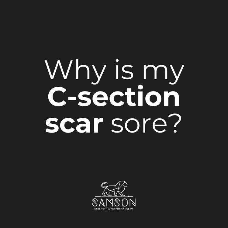 Why is my C-Section Scar Sore? — Samson Physical Therapy