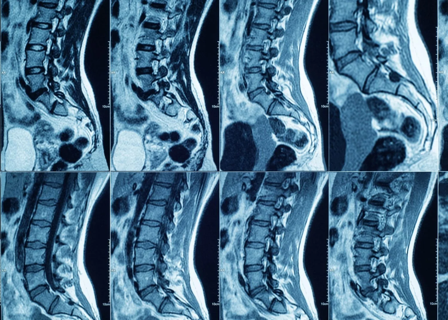 Should I get an MRI? — Samson Physical Therapy