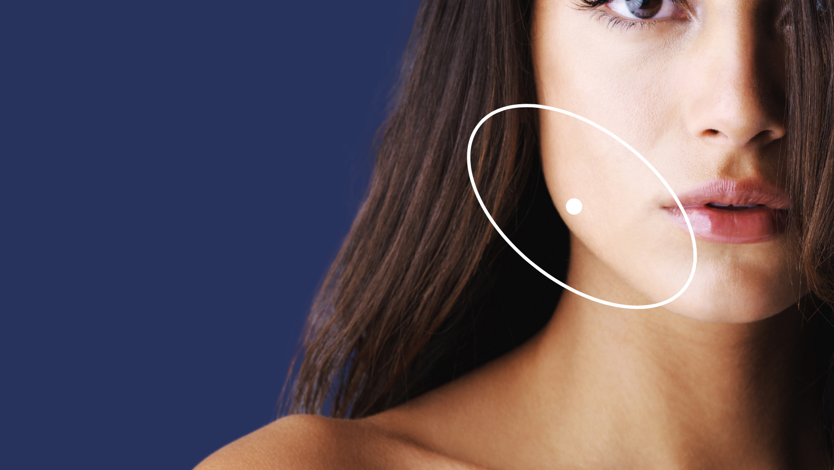 Botox — Nu Image Medical Esthetics