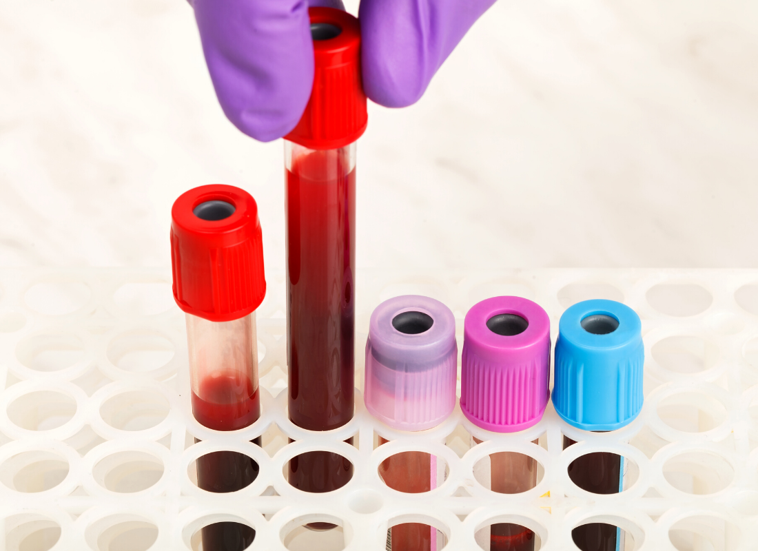 Brisbane Blood Collection Training | HLT37215 Certificate III in ...