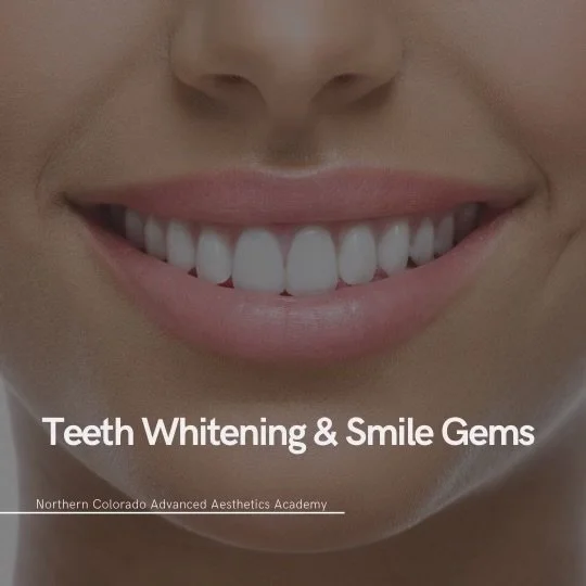 Teeth Whitening & Smile Gems — Northern Colorado Advanced Aesthetics ...