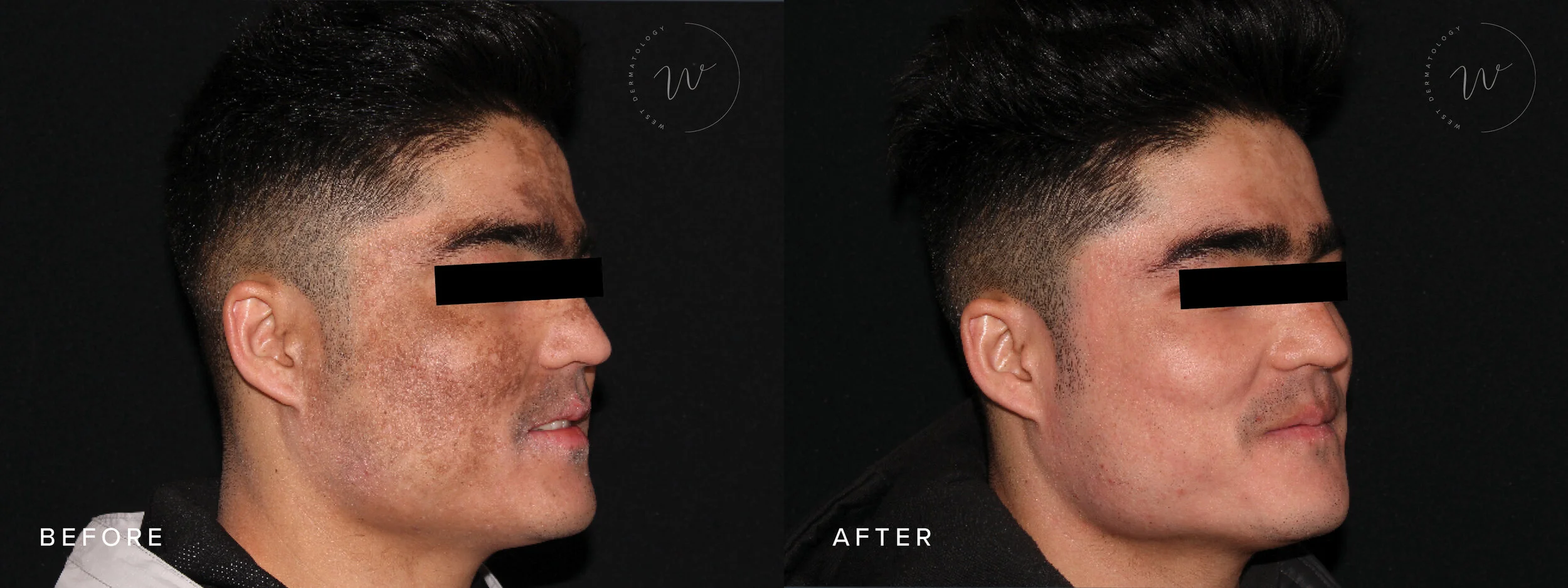 Preventative Aging Treatments for Men | West Dermatology