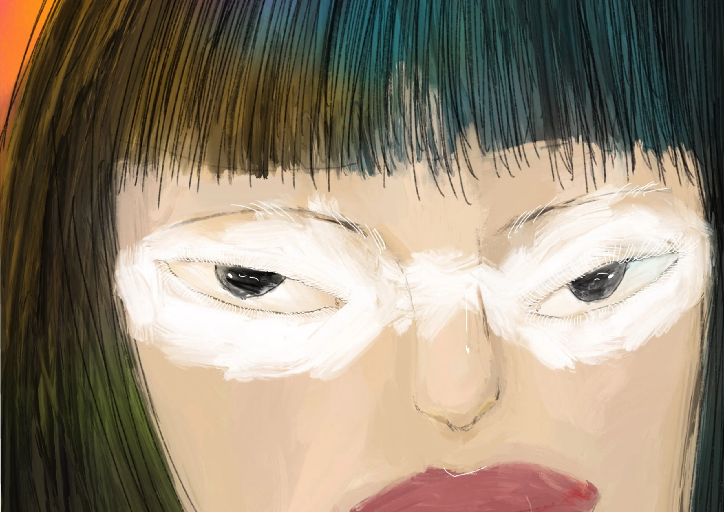 Vitiligo and Bipolar Disorder — Yilan Wang 一嵐