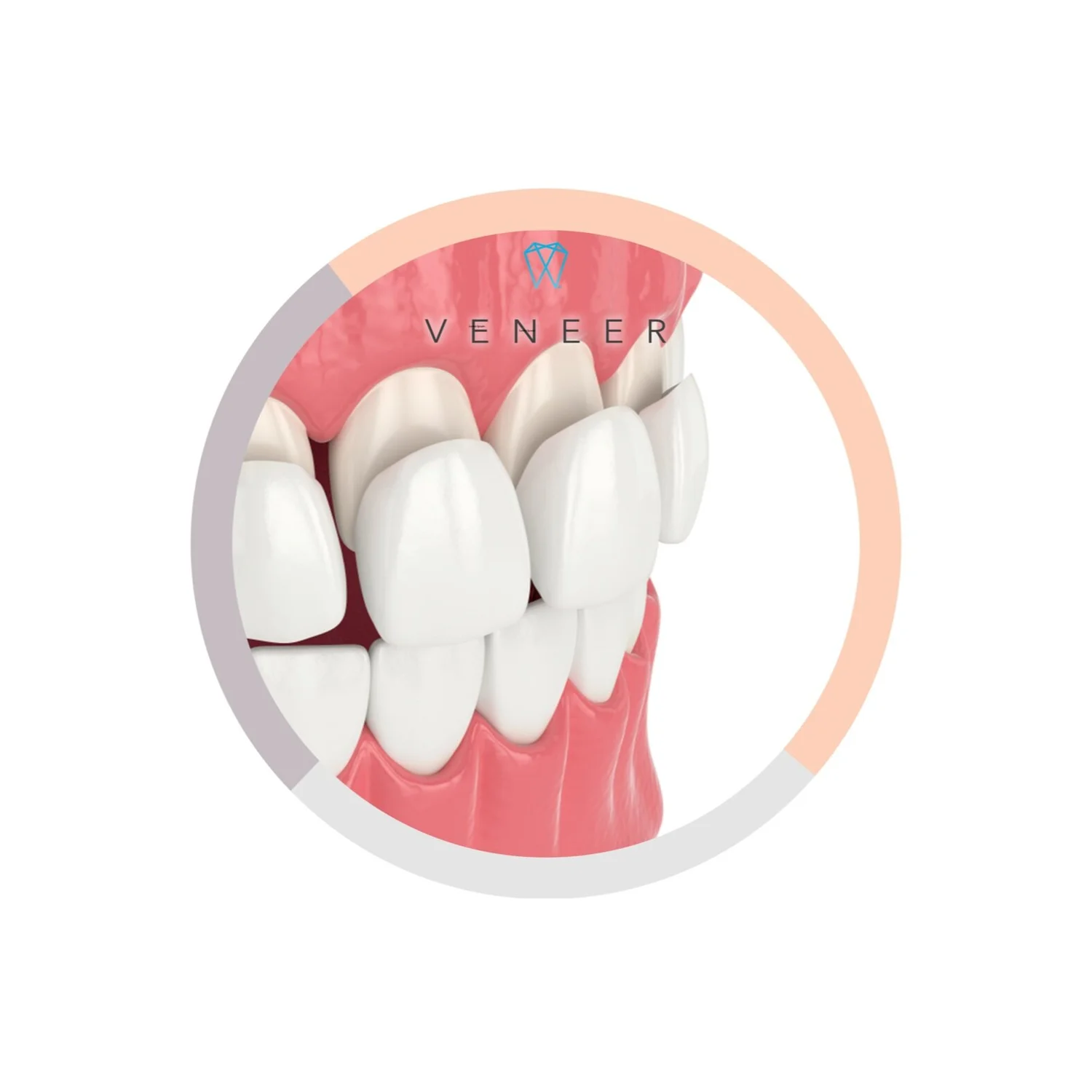 Dental & Mouth Rehabilitation and Restoration - Worn, Short, or Broken ...