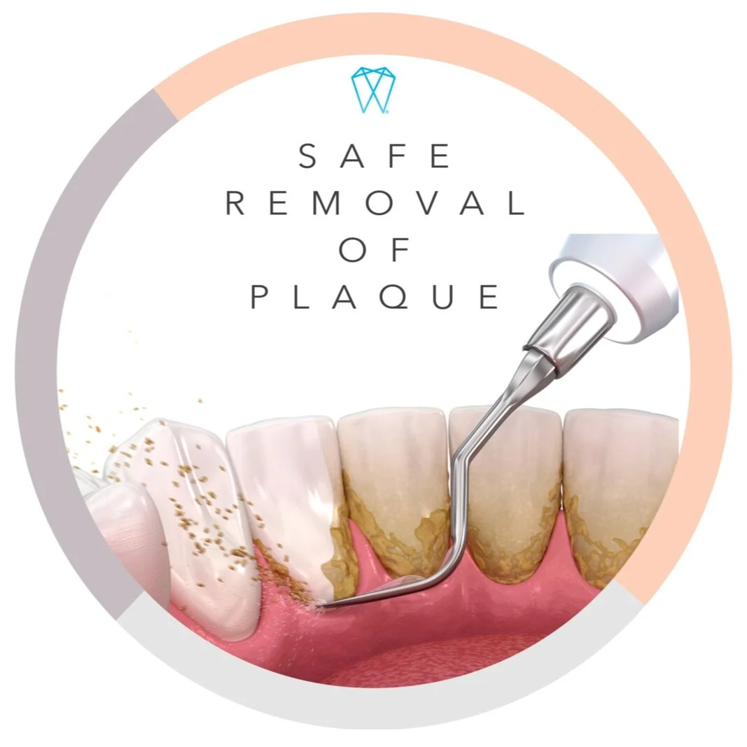 Check up & Dental Hygiene - Malvern East | General Dentist Toorak | VDG