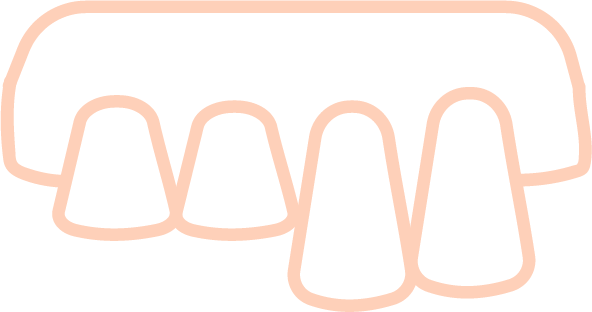 Full Smile Makeover and Mouth Reconstruction - Malvern | Melbourne Dentist