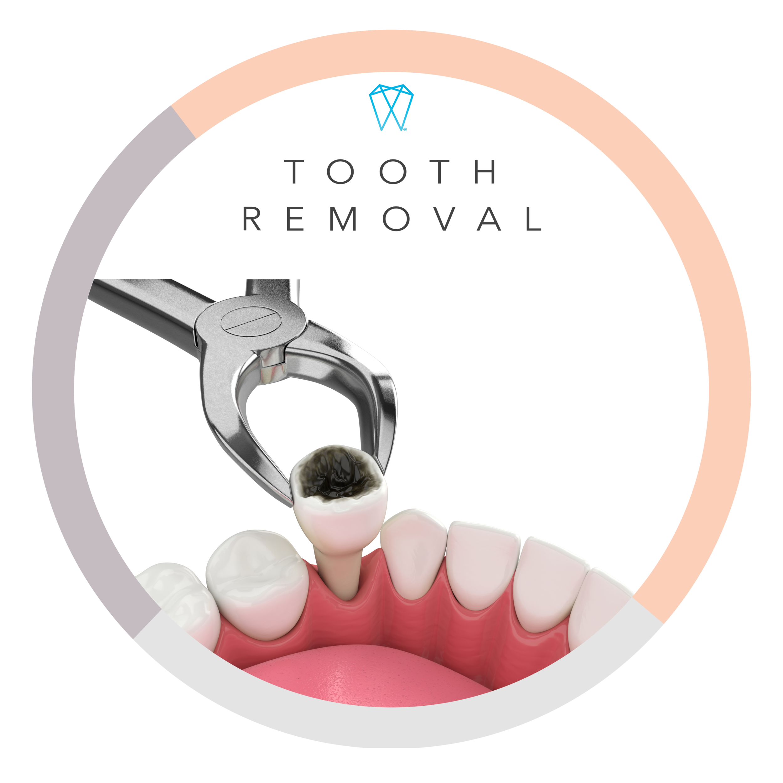 Full Smile Makeover and Mouth Reconstruction - Malvern | Melbourne Dentist