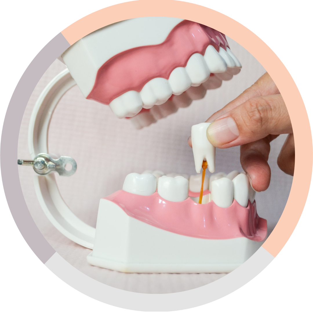 Gum Recession - What to do Next? Melbourne Dentist in Malvern East
