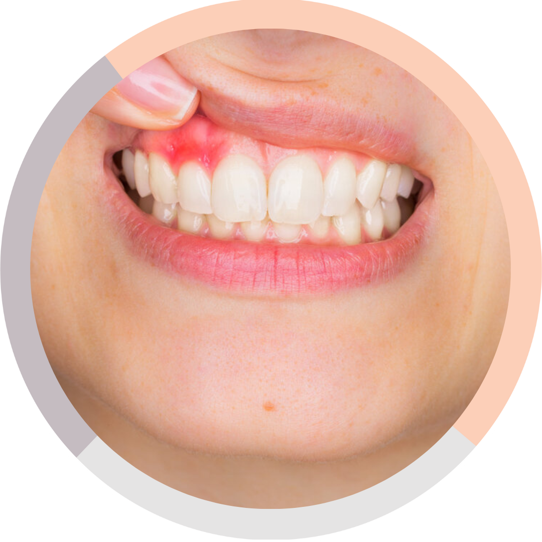 Dental Emergency, Broken Tooth, Knocked Out Teeth - Malvern East ...