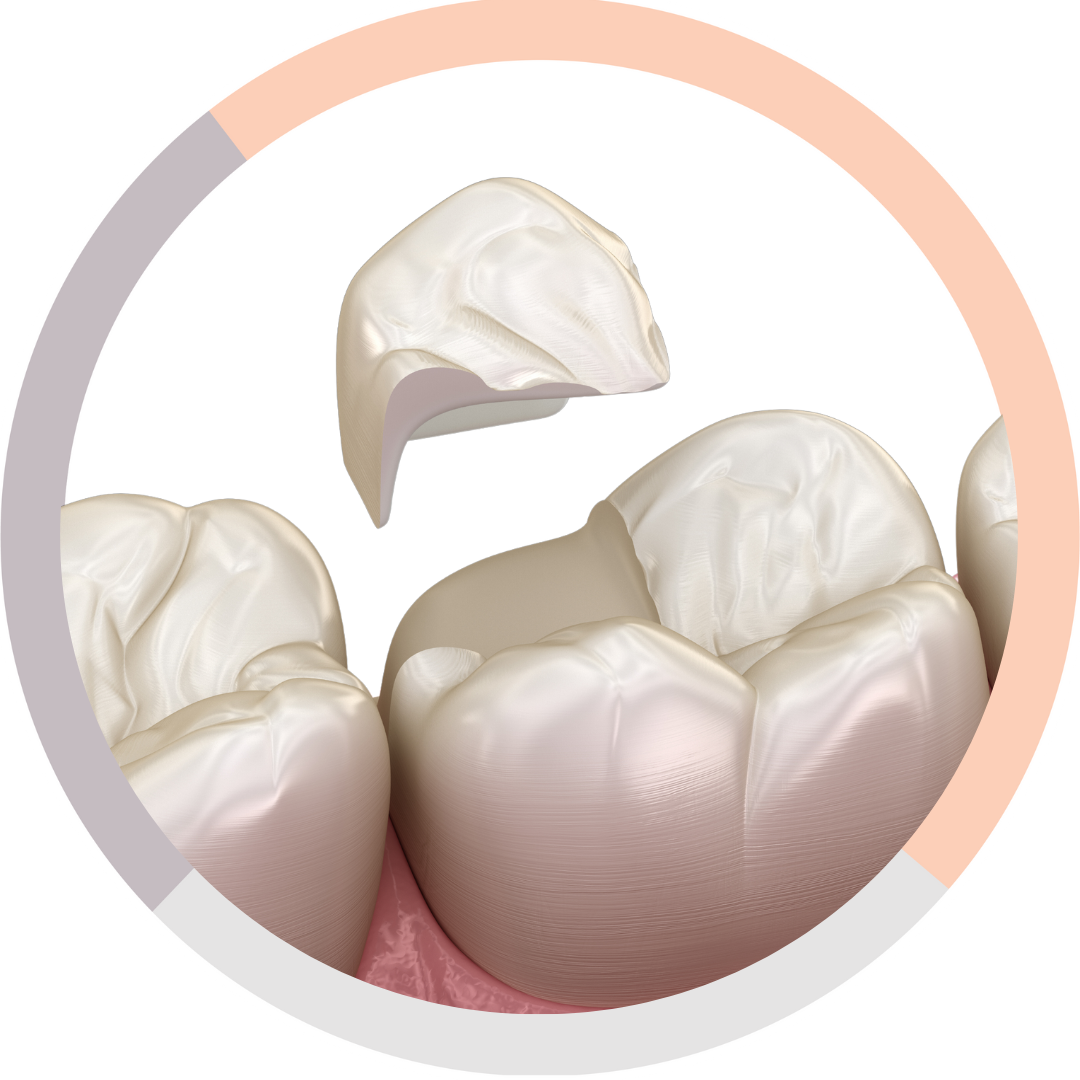 Dental Emergency, Broken Tooth, Knocked Out Teeth - Malvern East ...