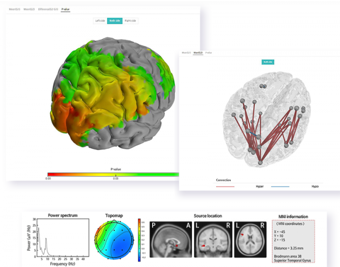 Neurofeedback Certificate Training Program — Successful Practitioner