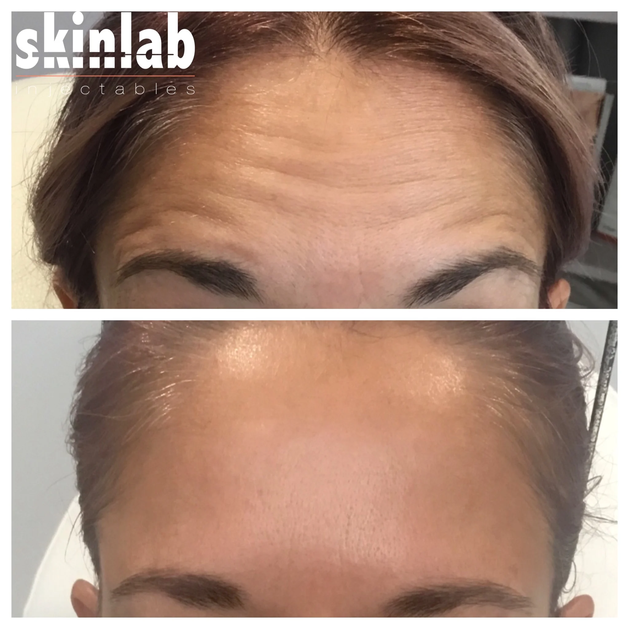 Our Work — Skinlab Injectables
