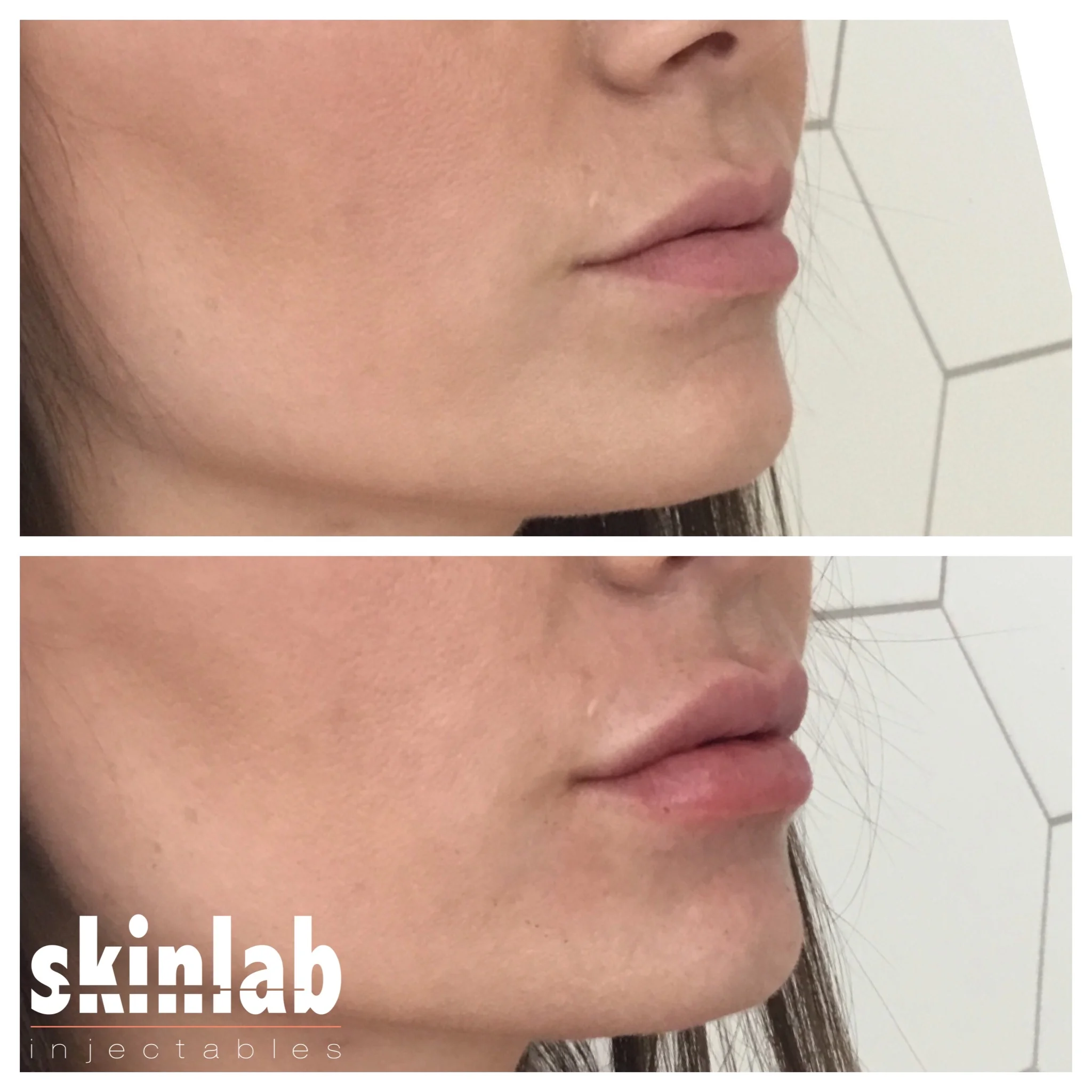 Our Work — Skinlab Injectables