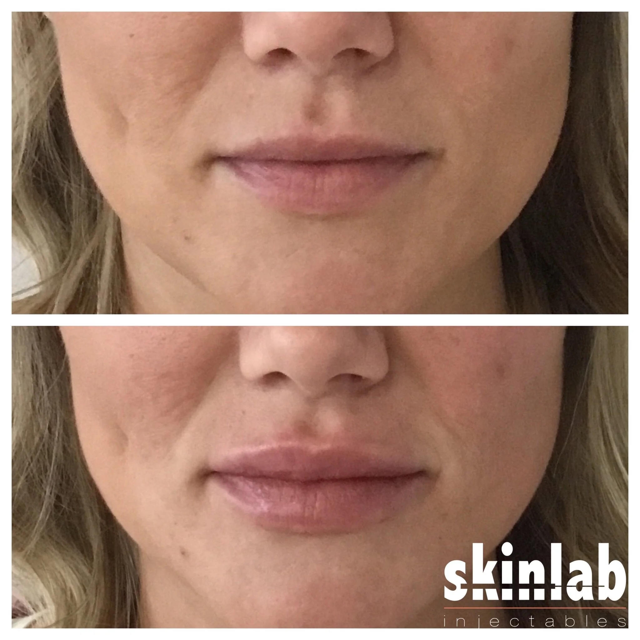 Our Work — Skinlab Injectables