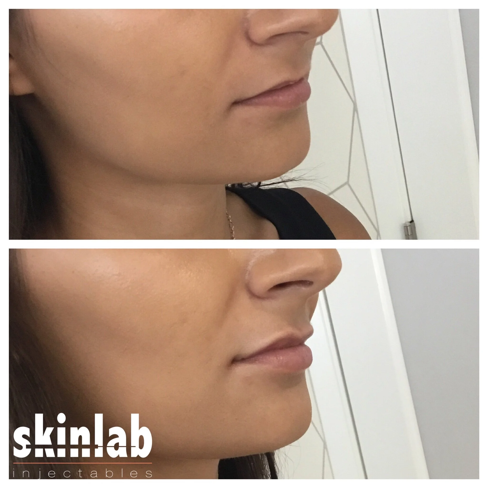 Our Work — Skinlab Injectables