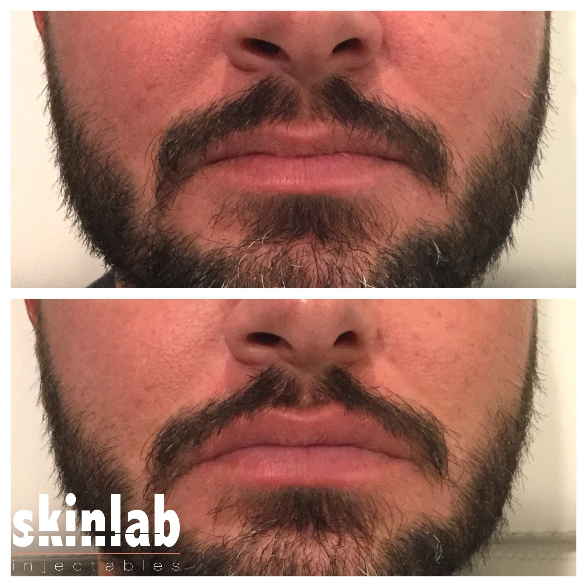Our Work — Skinlab Injectables