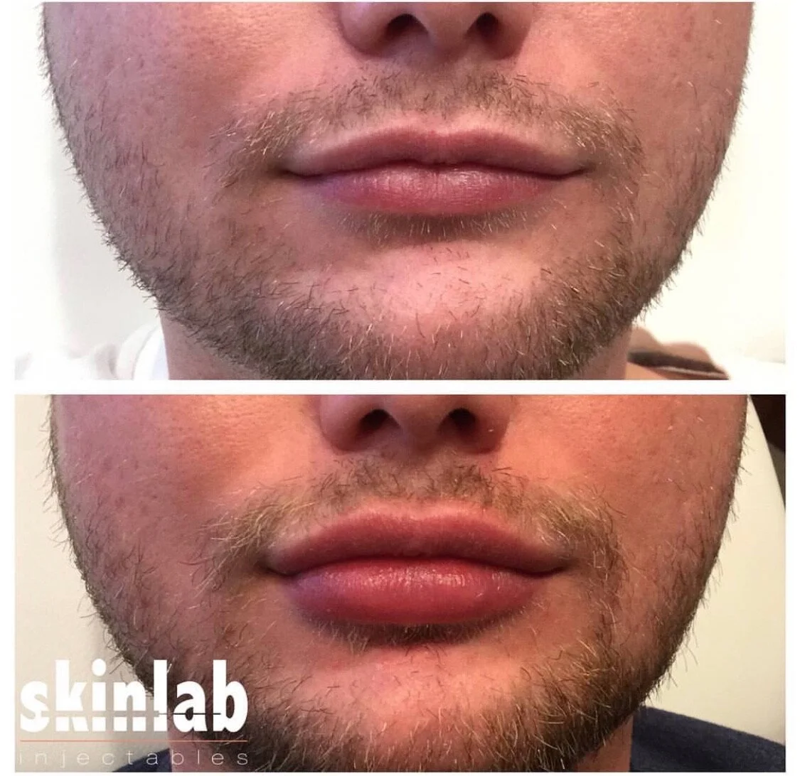 Our Work — Skinlab Injectables
