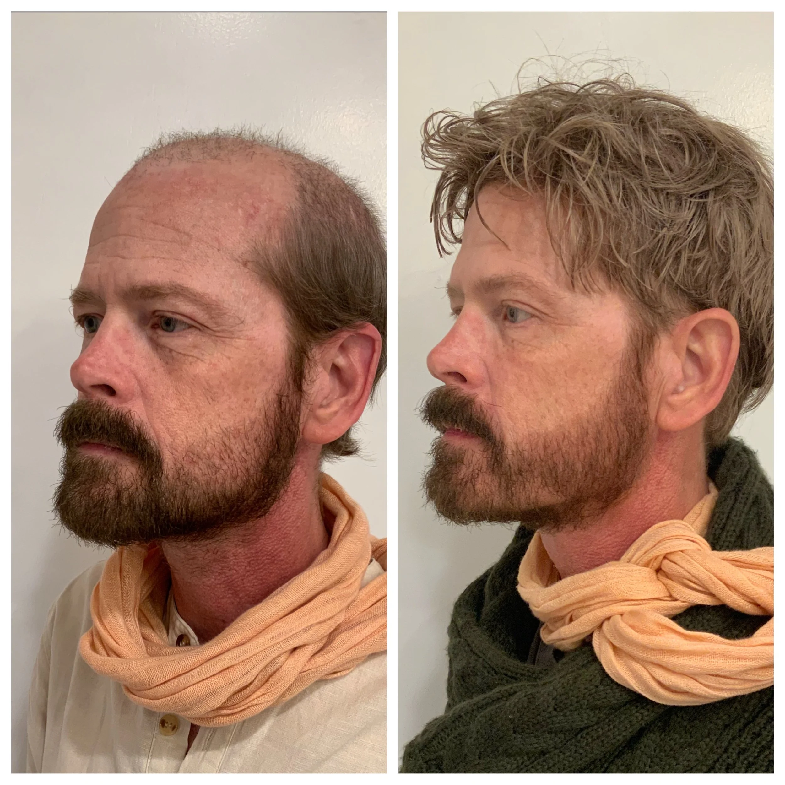 Our Work — Skinlab Injectables