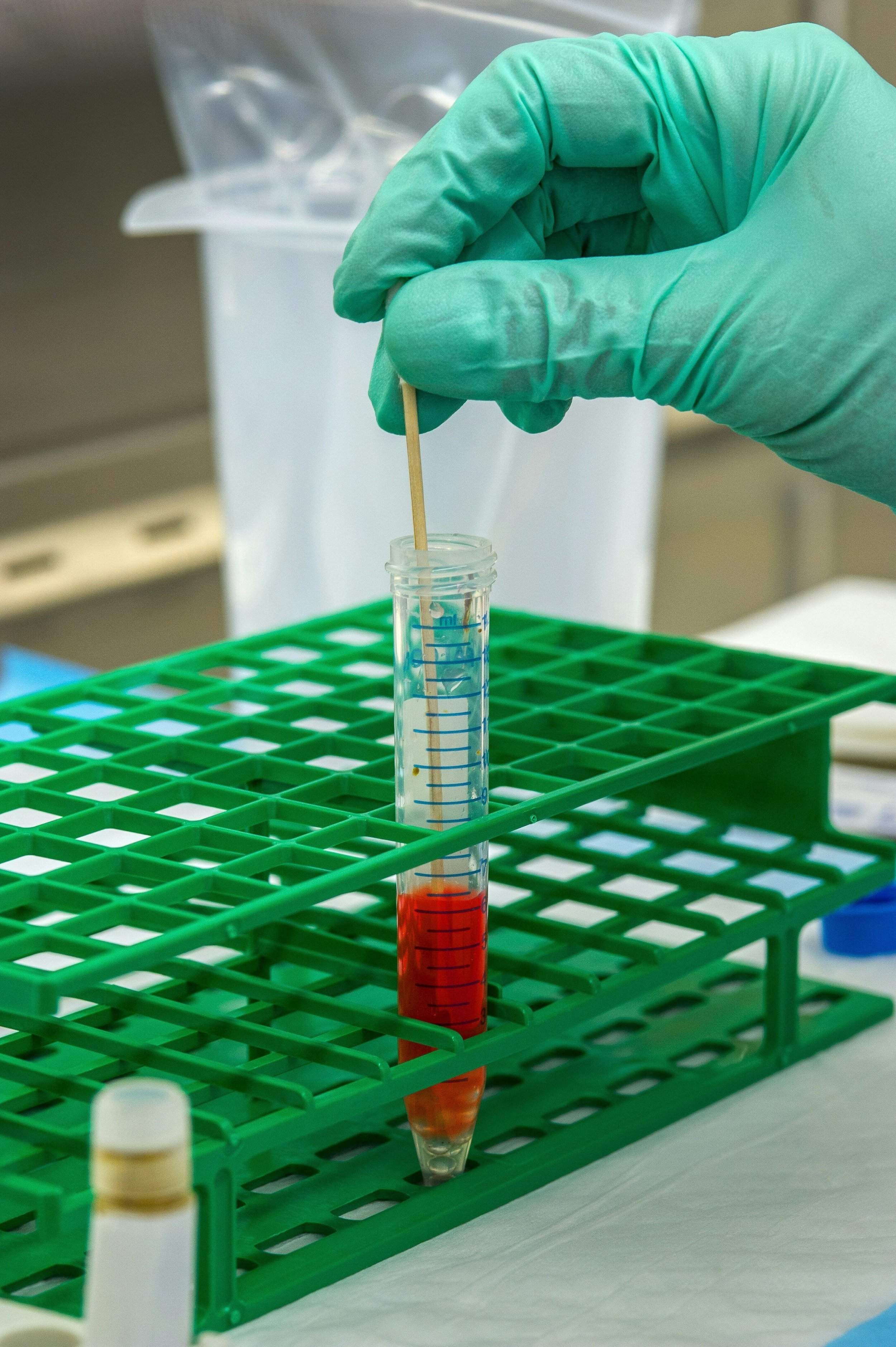 Understanding Liver Function Blood Tests: A Comprehensive Guide Understanding Liver Function Blood Tests: A Comprehensive Guide