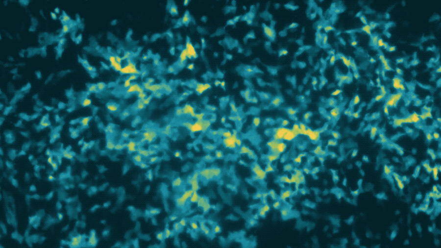 Lung-Chip — Emulate