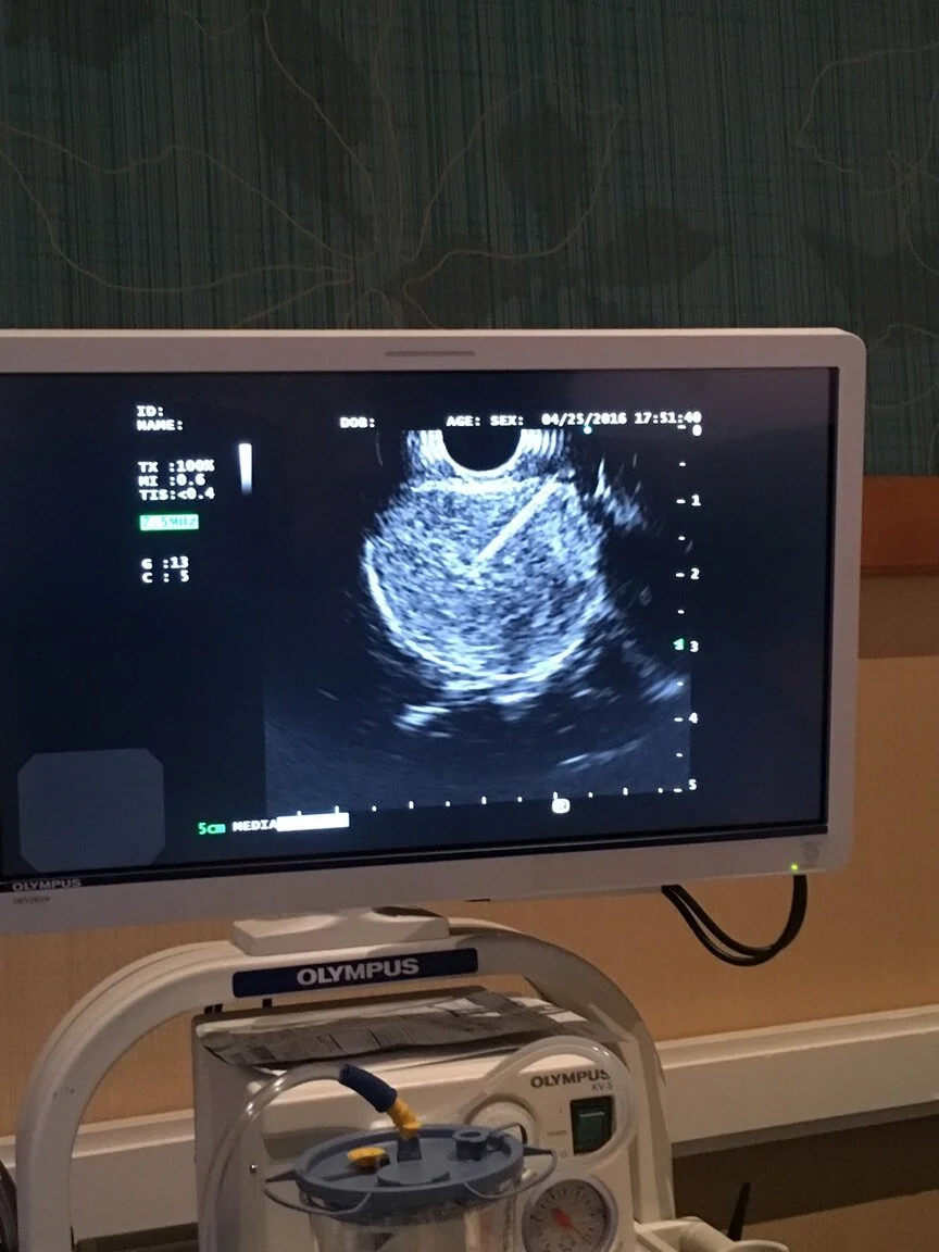 Gastrointestinal Endoscopy Specimen Models and Simulators — EndoSim ...