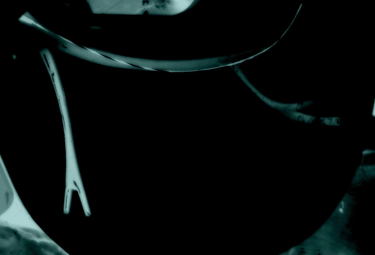 EASIE-R4 Simulator — EndoSim Evidence-Based Simulation