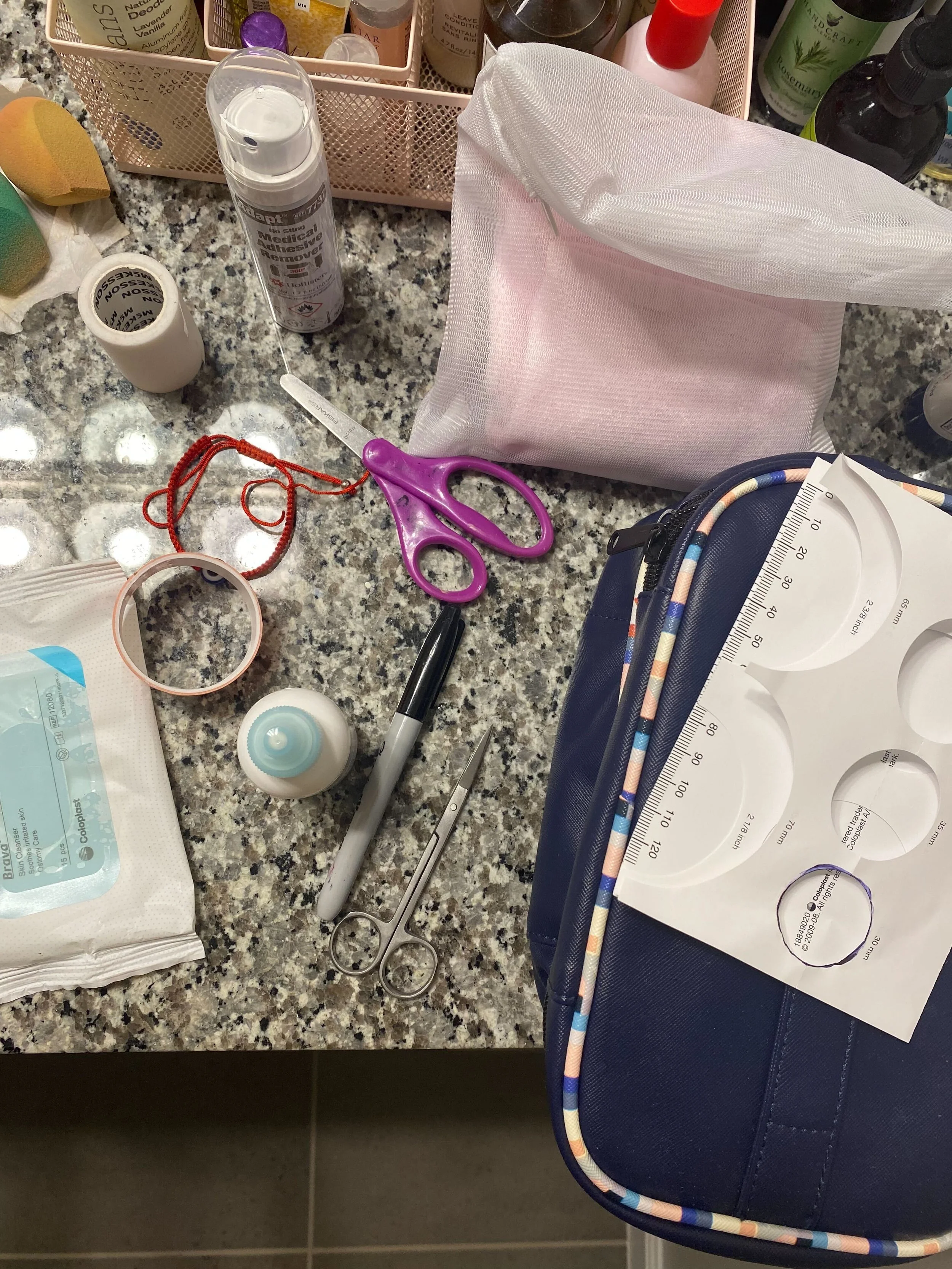 My Ileostomy Story — Crohn's & Colitis Young Adults Network