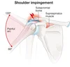 What Type of Shoulder Impingement Do You Have? | Osteopathy for Tennis ...