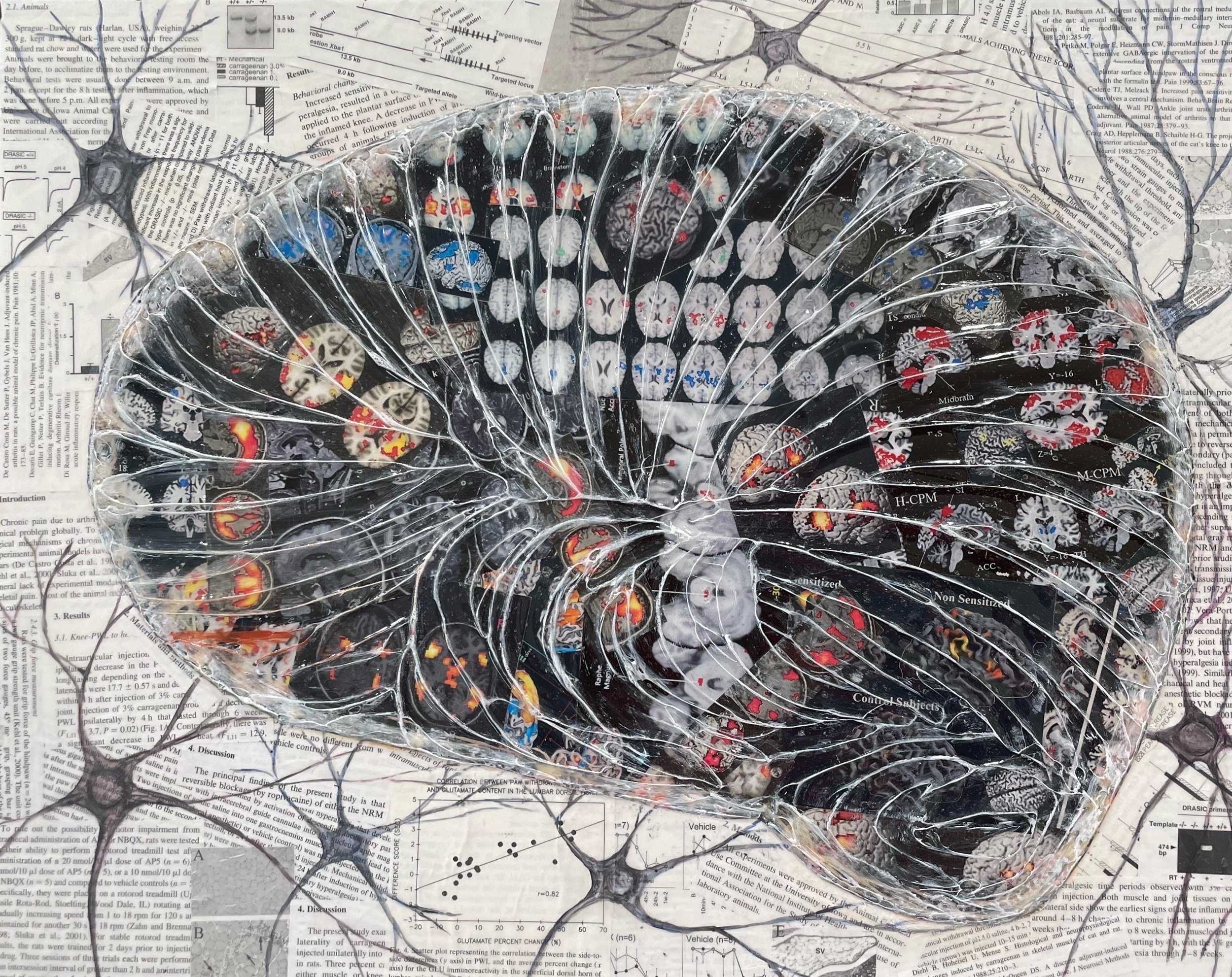 Brain Collection — Cells of Life