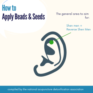 The 5 points of the NADA Protocol — Acupuncture for Community : Simple ...