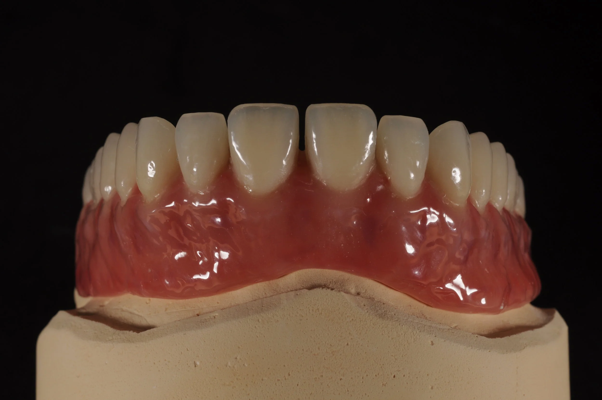 Prosthodontics — Queensway Dental Laboratory