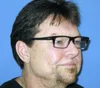 Nasal Prosthesis - Prosthetic Nose | Wisconsin — Life-like Prosthetics