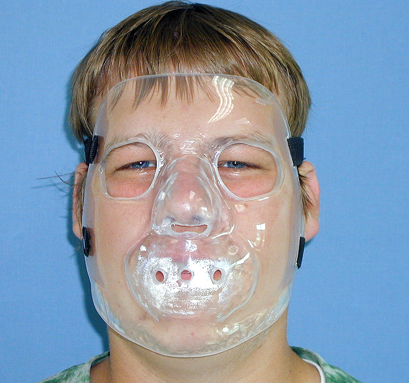 Broken Nose Mask Soccer