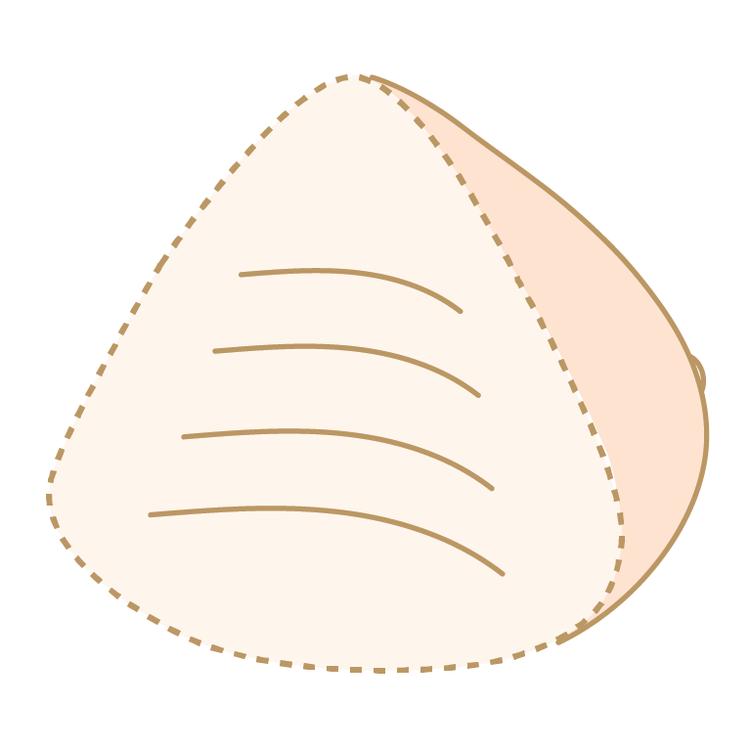 Breast Prosthesis - Nipple Prosthesis - Post-mastectomy Care — Life ...