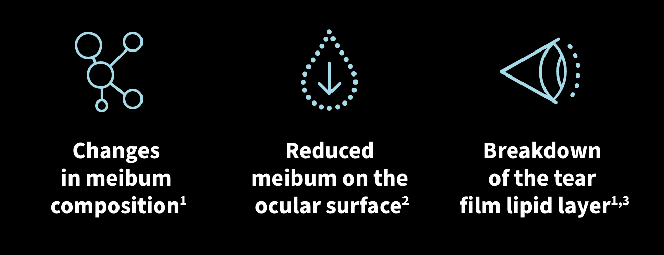 Lumenis OptiLight IPL: A New FDA Approved Treatment for Dry Eye Disease ...