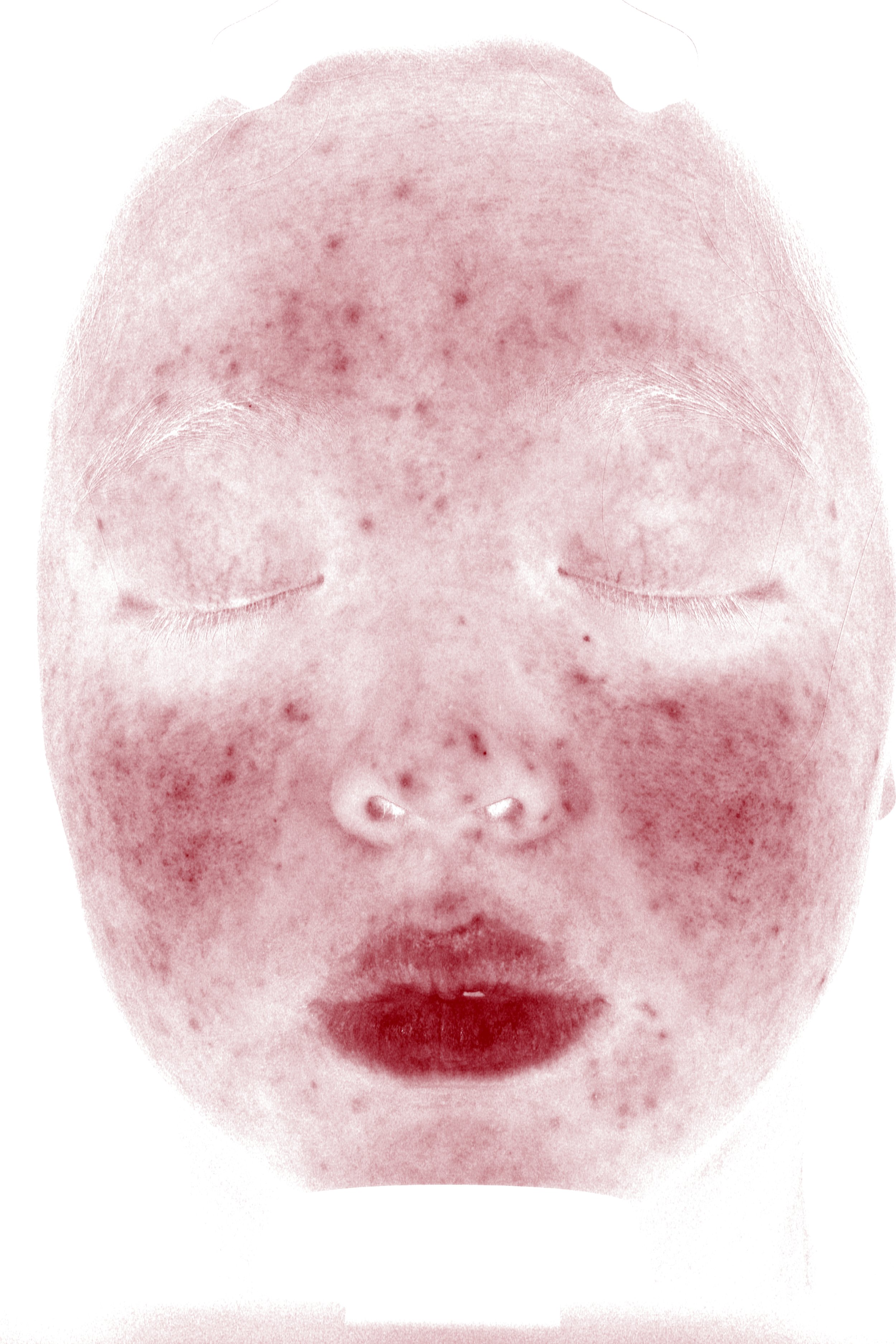 Dr Nina Wines- Medical & Laser Dermatologist