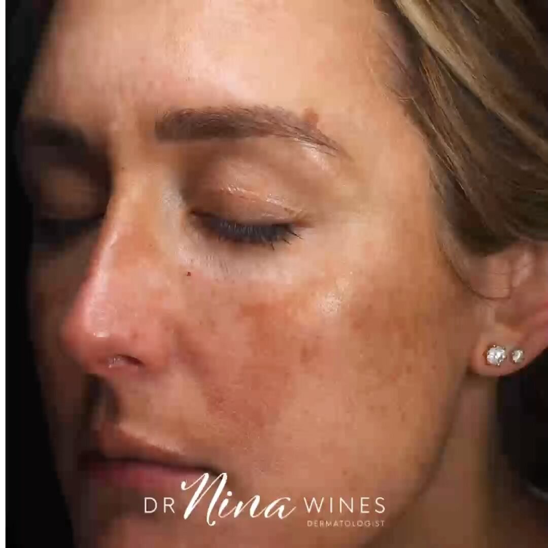 Dr Nina Wines North Shore Laser And Cosmetic Dermatologist Sydney