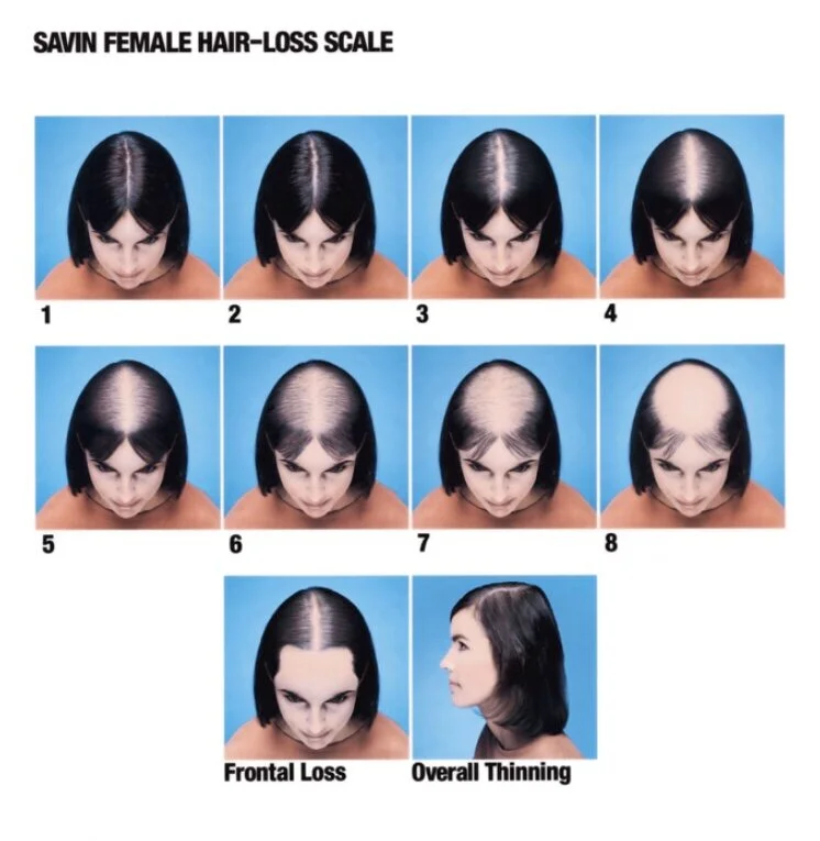Scalp Micropigmentation Prices — Elite Permanent Makeup & Aesthetics