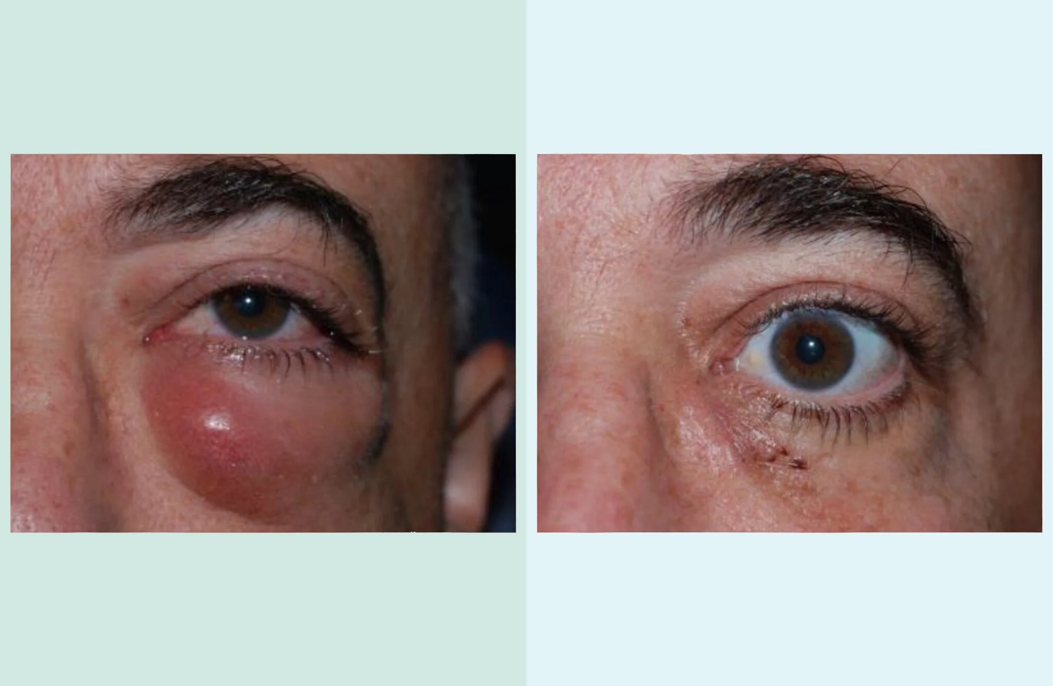 Dr. Chip Cole - Oculus Plastic Surgery - Atlanta GA