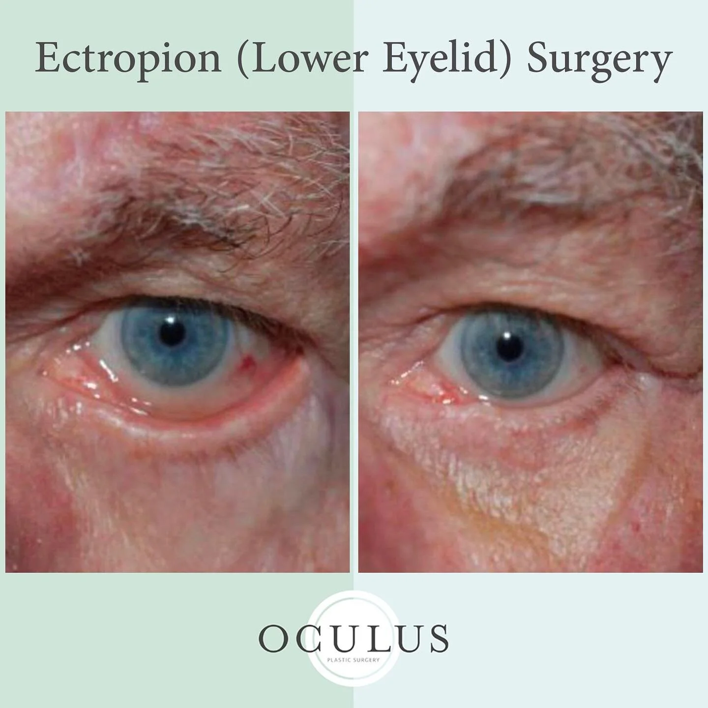 Dr. Chip Cole - Oculus Plastic Surgery - Atlanta GA