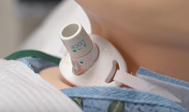 Suctioning and Tracheostomy Management — Clinical Experts