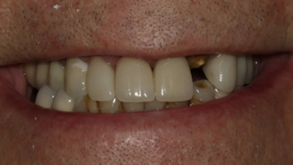 AAA Dentists — Gallery