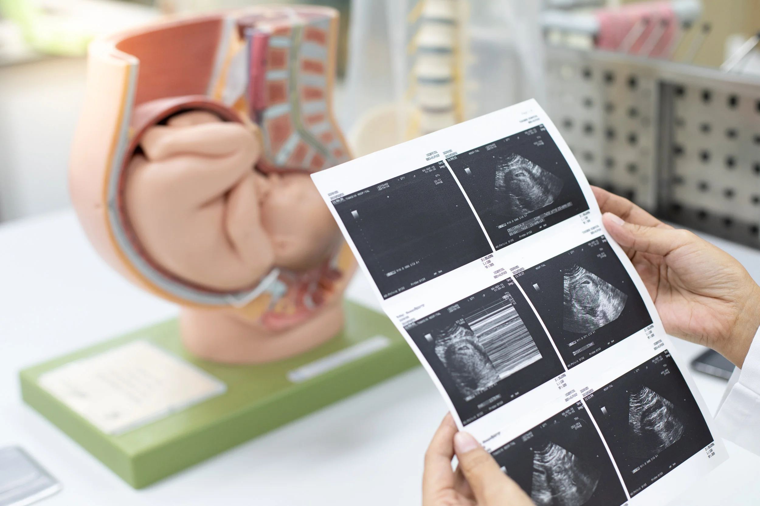 What is Trisomy — SOFT Australia