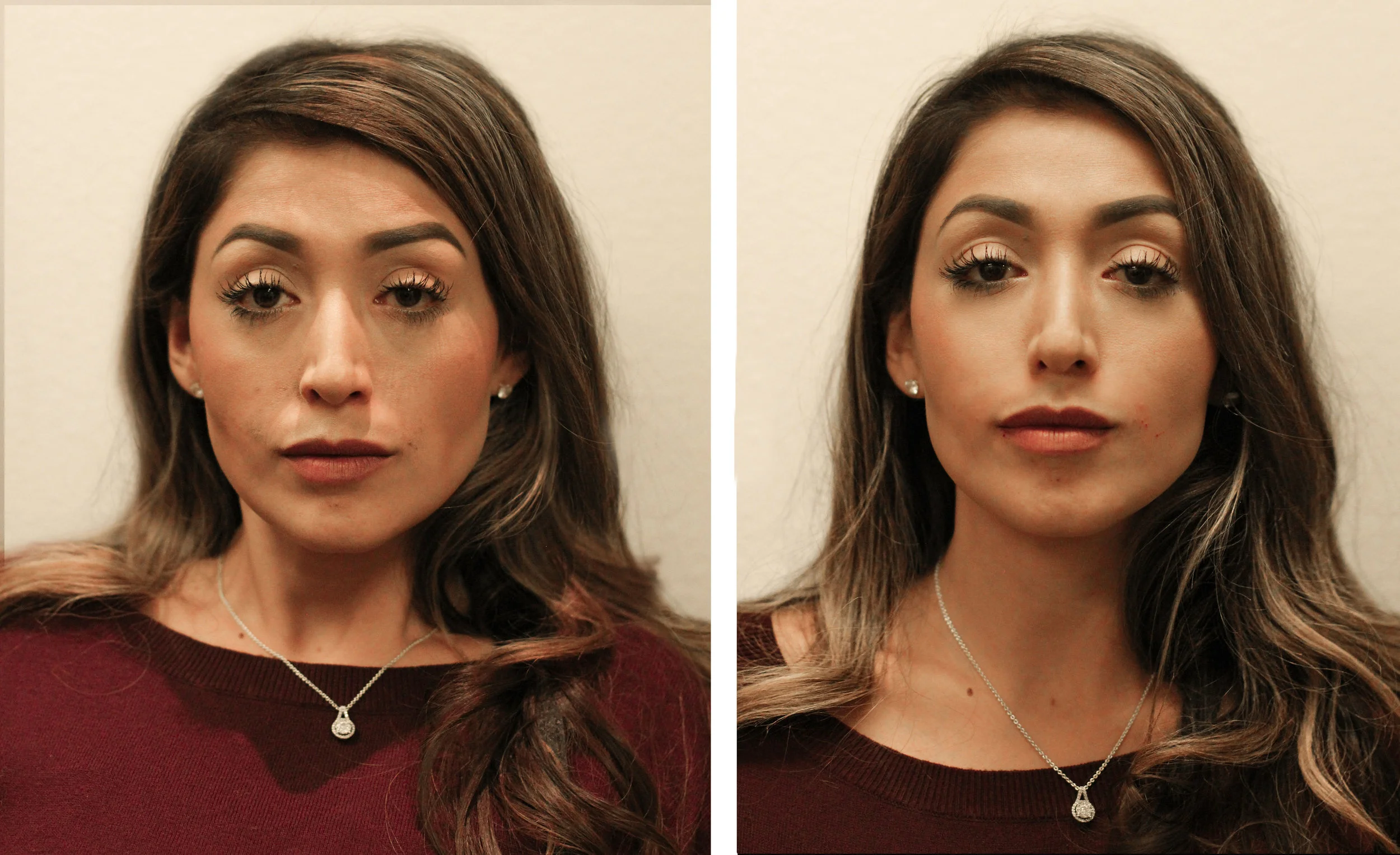 Jessica Friedman RN, BSN